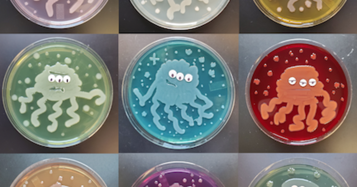 Ella Rotman wins Agar Art contest | Department of Microbiology | The ...